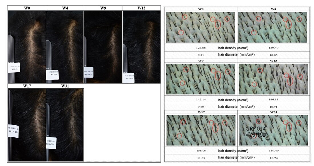 Een haargroeimiddel of een middel tegen haarverlies? • Nieuws - De Kapper