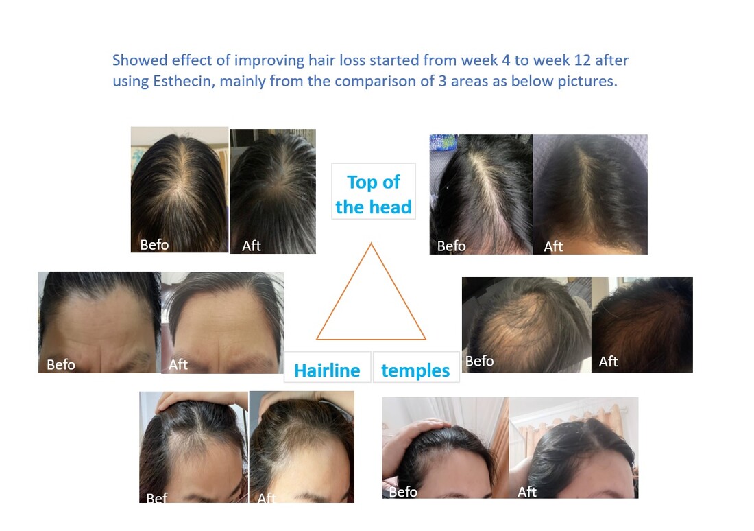 Een haargroeimiddel of een middel tegen haarverlies? • News - De Kapper