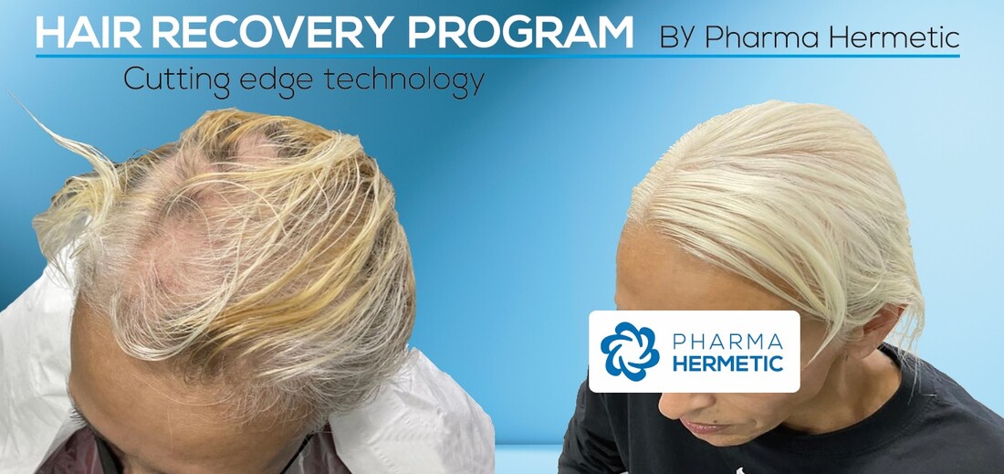 Maak kennis met het Hair Recovery Program • Nieuws - De Kapper